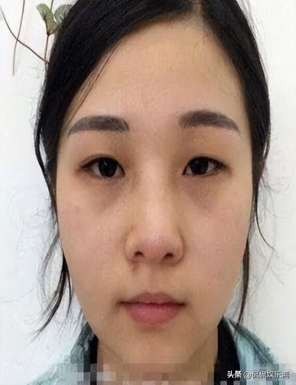 He Chengxi: He started plastic surgery at the age of 15. After 8 years ...