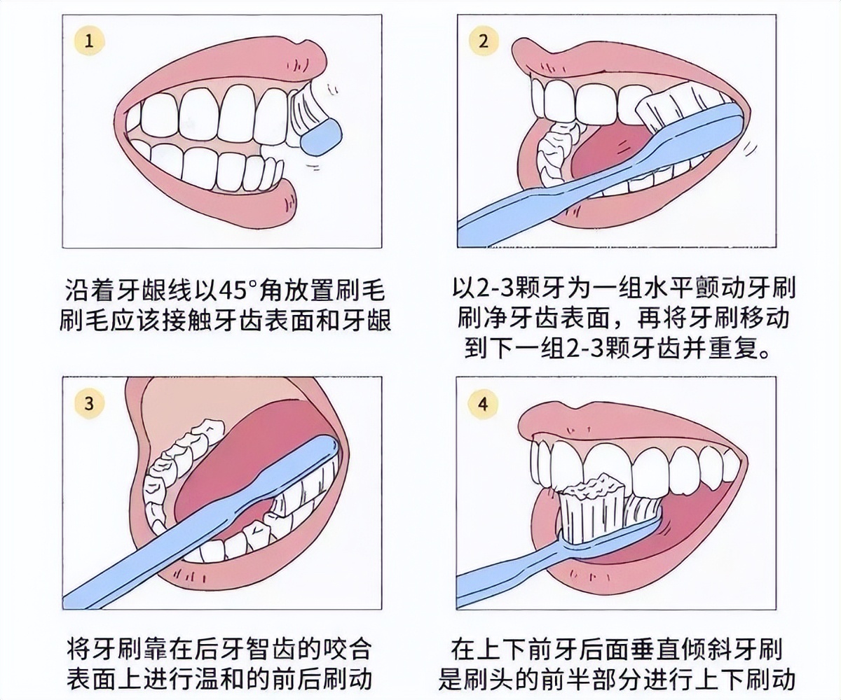 Dr. Brush tells you: the use method and precautions of lazy electric ...