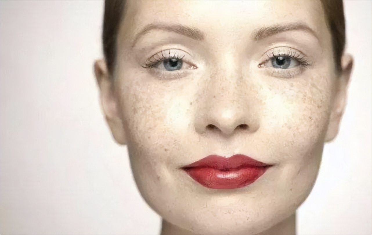 Why do some people have "age spots" on their faces, while others are ...