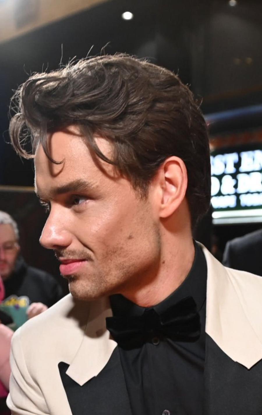 British idol actor Liam Payne suspected of plastic surgery, enlarged ...