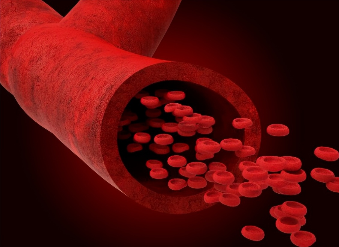 Keeping blood vessels open is the key to longevity? Do 6 things well ...
