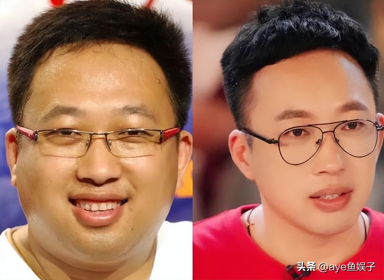 In the entertainment industry with a pair of porcelain teeth per capita ...