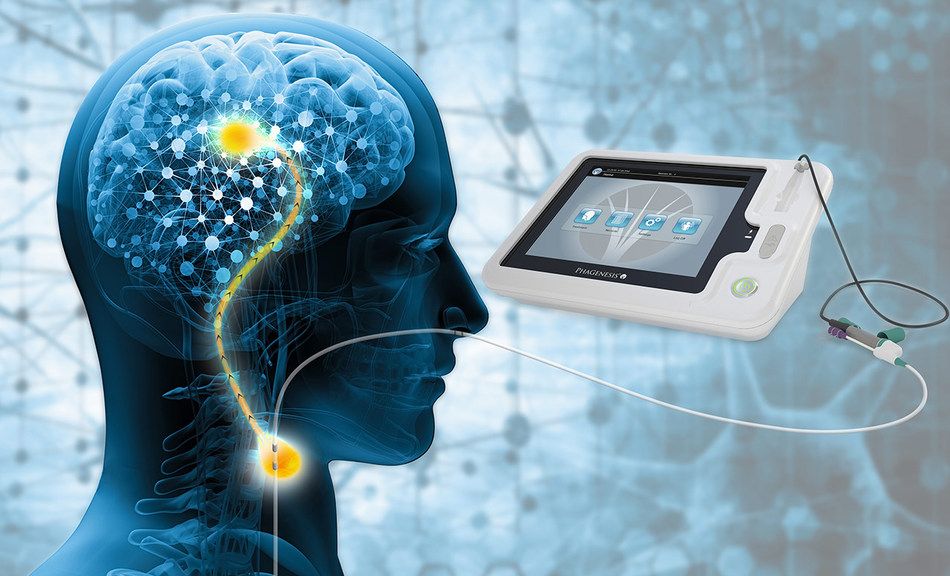 Neurostimulator approved by FDA, Nestlé Health has invested - iNEWS