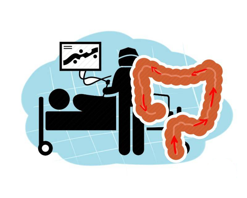 How long does a colonoscopy screening take?What to do to prepare ...
