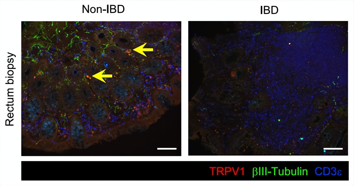 The role of TRPV1+ pain receptors in gut immunity and gut microbial ...