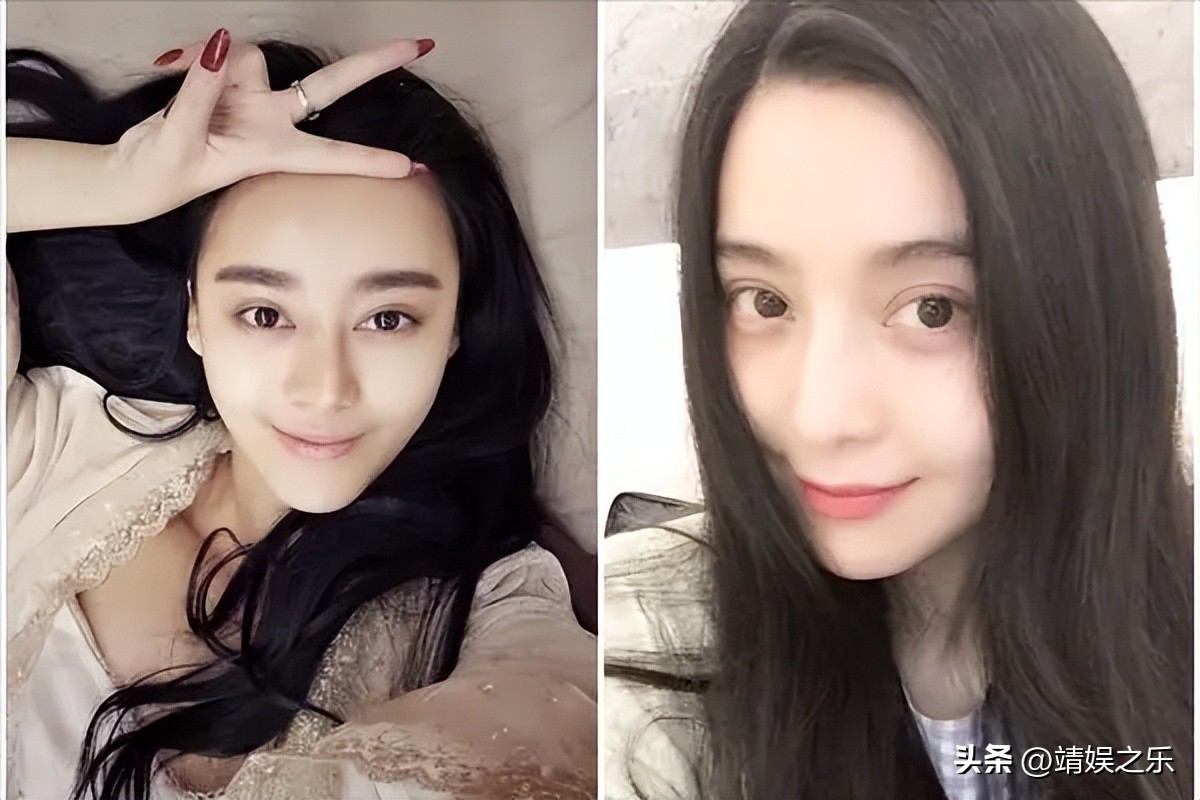 Spending 8 million plastic surgery and marrying the chief surgeon, He Chengxi's road to success ...