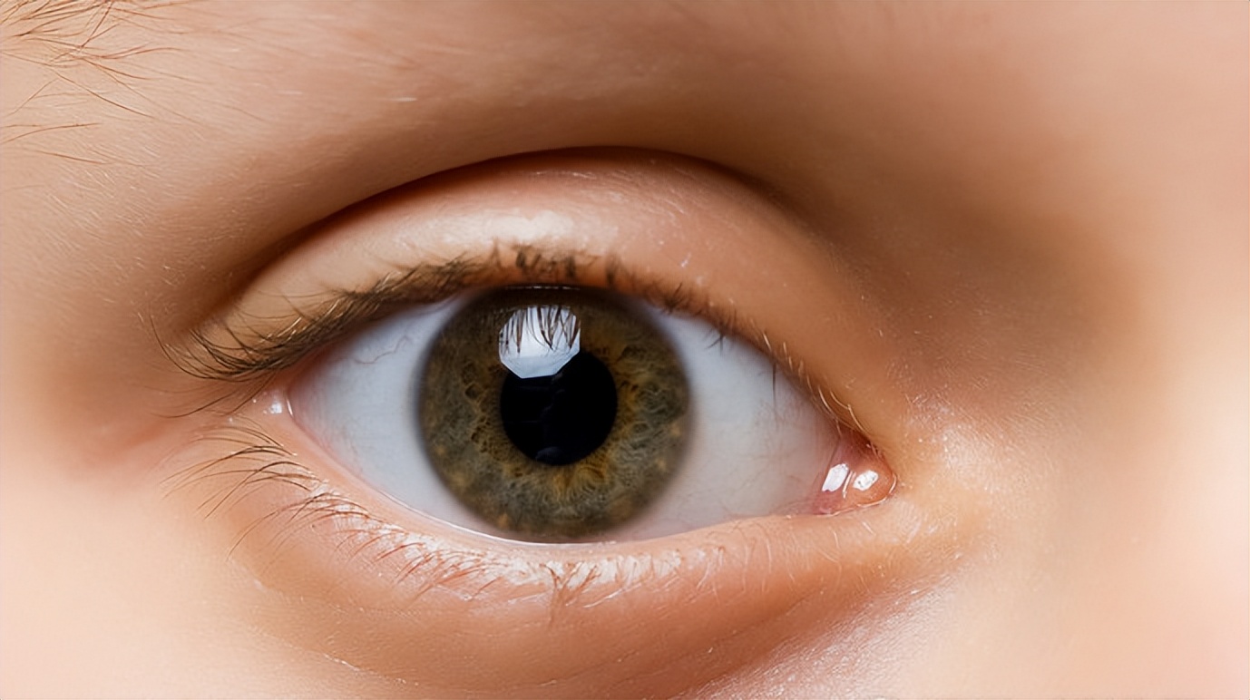 Why do I have to cover surgery if I have an eyeball and wear a ...