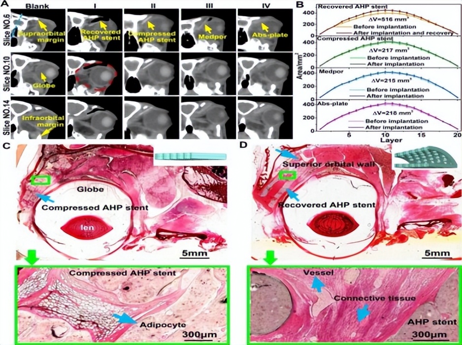 4D printing of a new shape memory composite material AHP—a new option ...