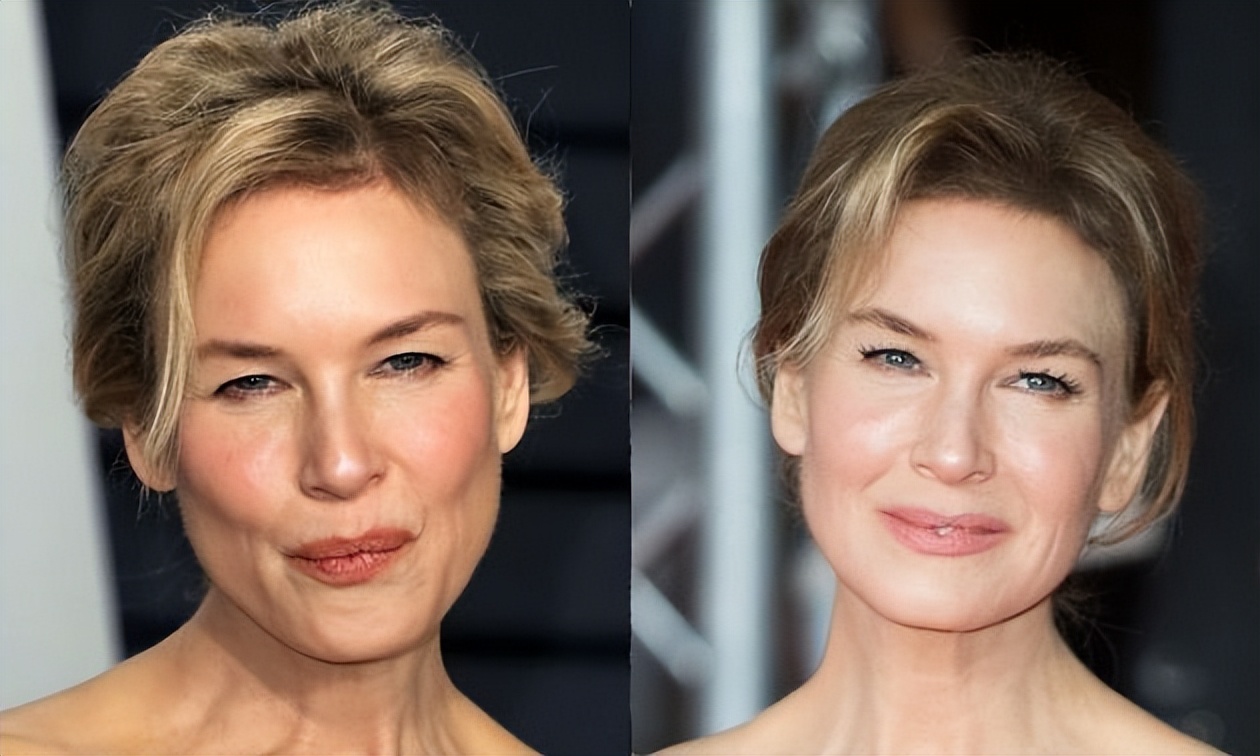 10 naturally beautiful stars suspected of plastic surgery, how many do ...