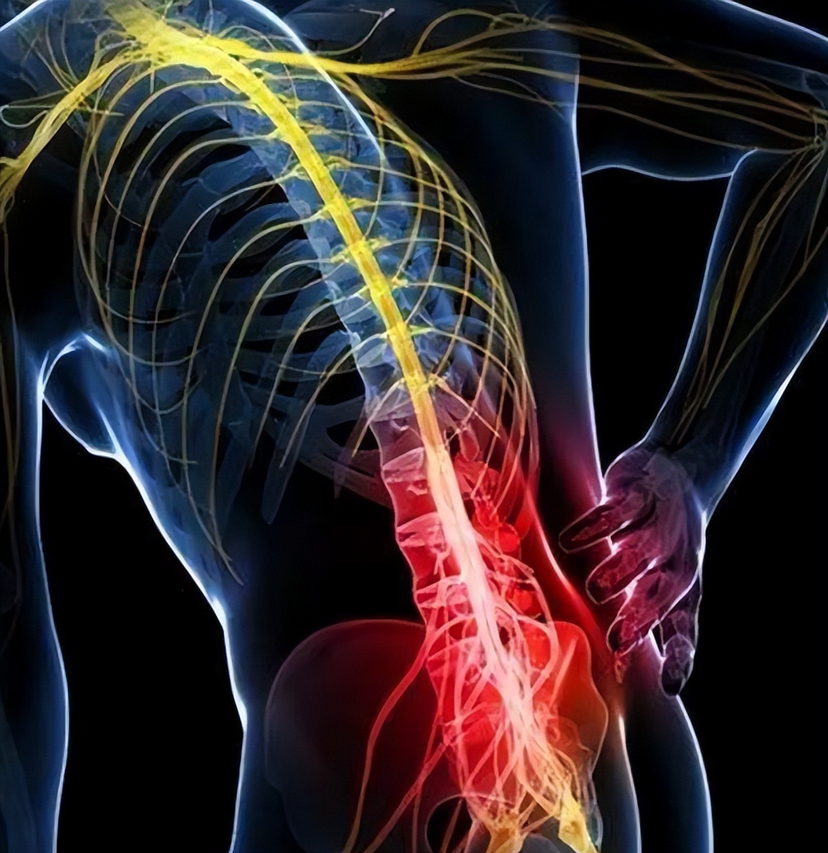 Doctor: Is the lumbar disc herniation painful? Keep these three ...