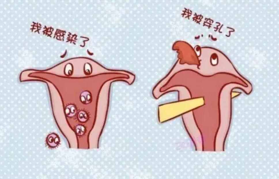 The "birth control ring" in many women has been forgotten, remind ...