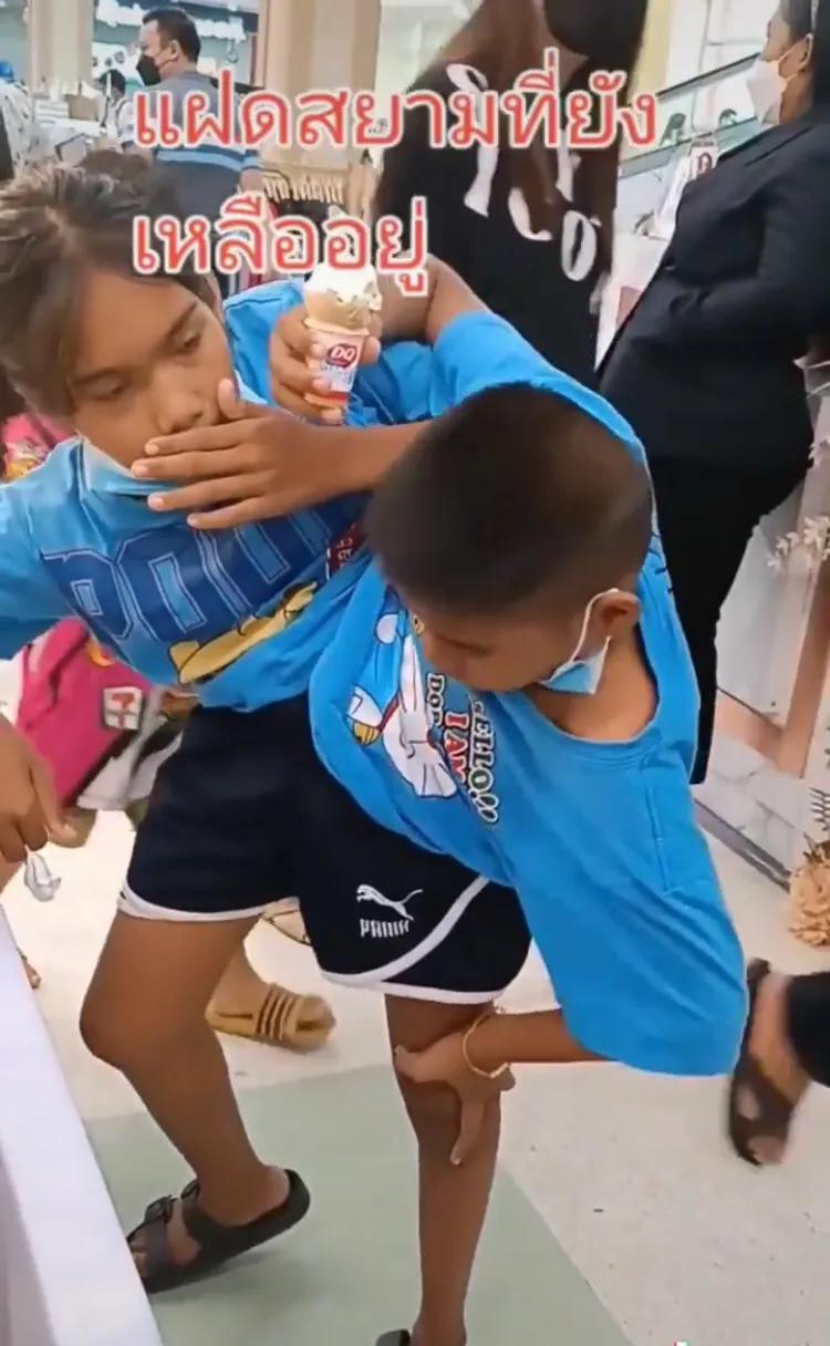 Rare conjoined twins in good condition - iNEWS