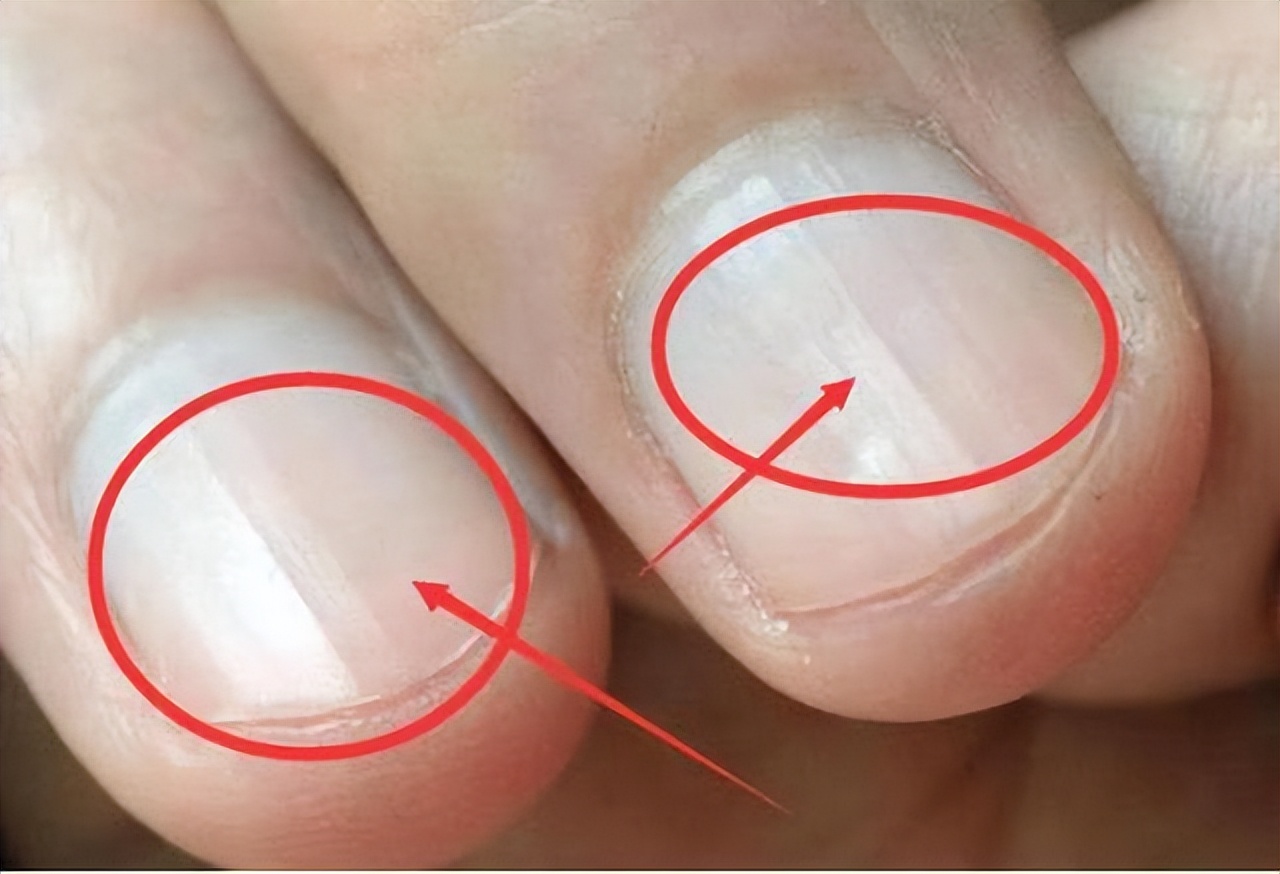 Bad liver, foot prophet?If your feet send out these 4 signals, it is ...