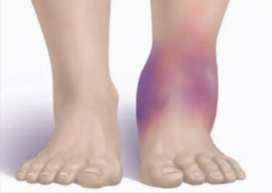 You should do this after you stab your foot, are you doing it right ...