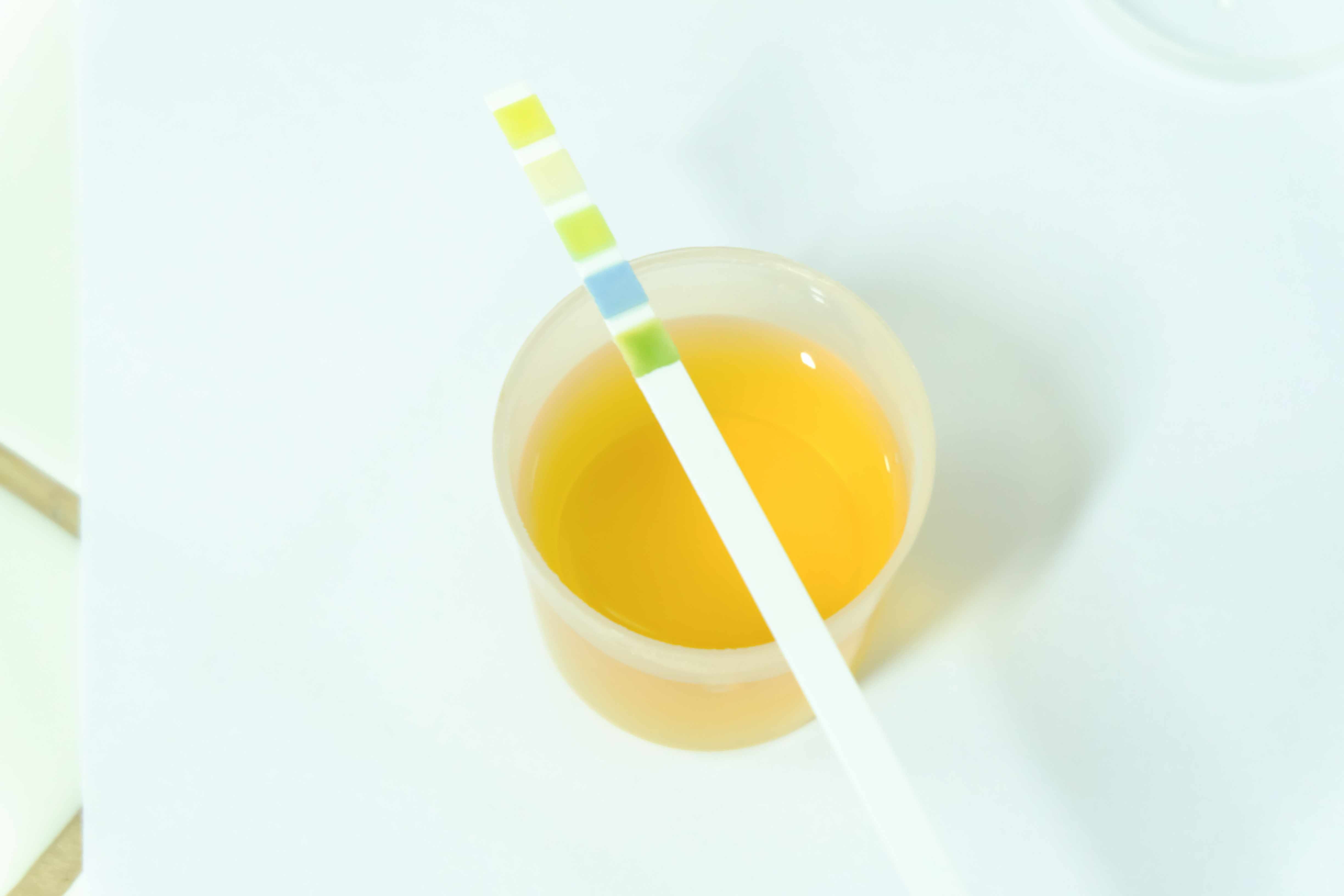 During the physical examination, these 3 indicators are abnormal, or ...