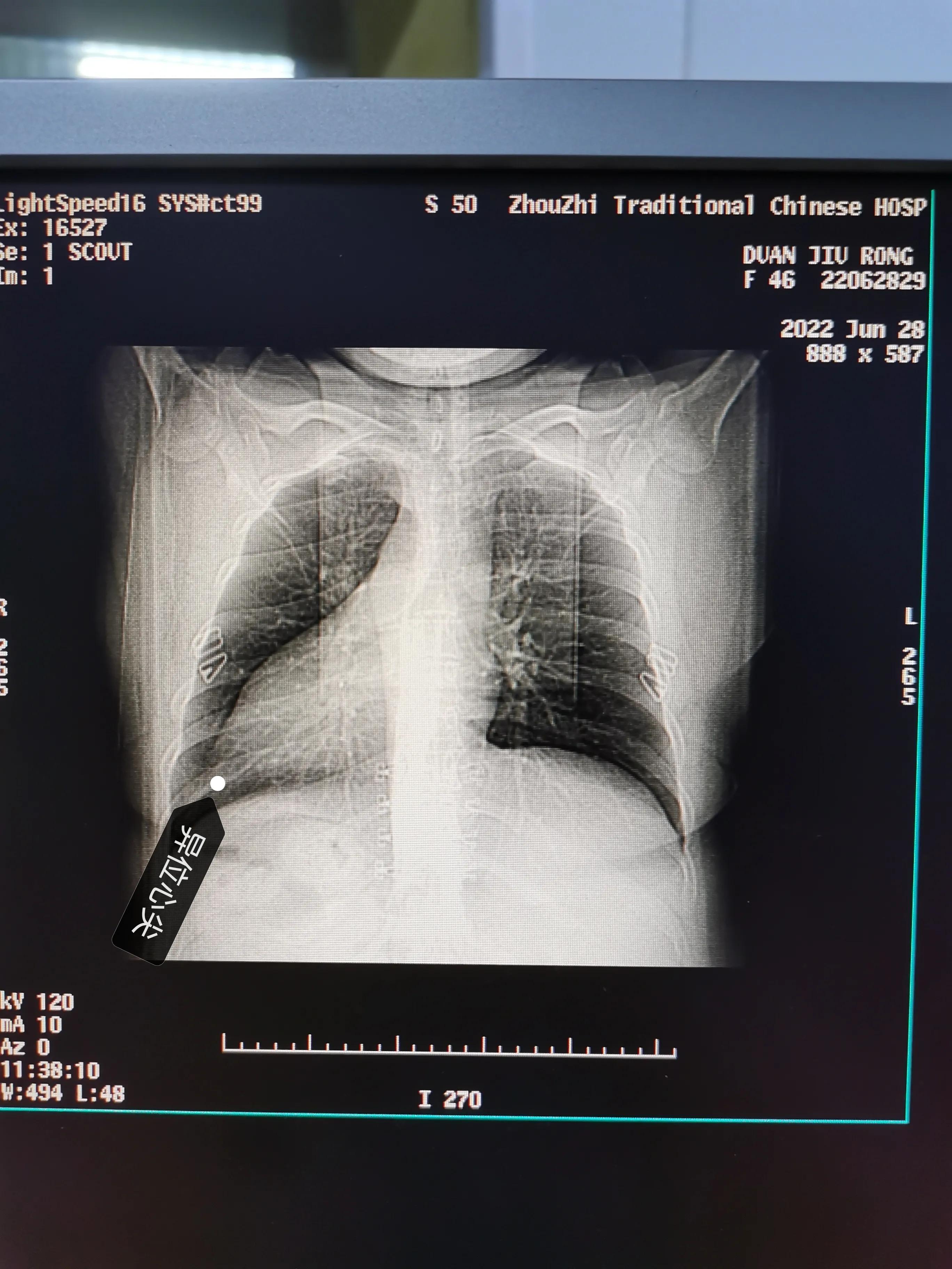 "Mirror Man" - Organ Reversed - iMedia