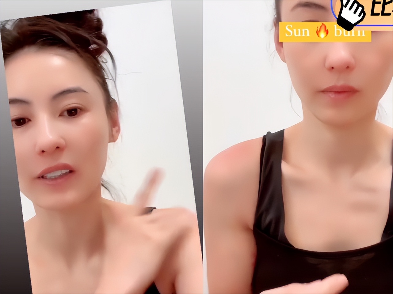 41 Year Old Cecilia Cheung Was Sunburned While Swimming She Only Wore