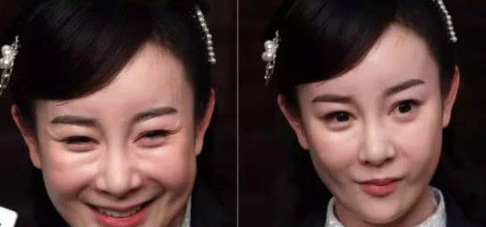 8 female celebrities whose faces were “disfigured by plastic surgery ...