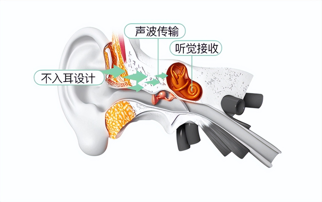 Bone conduction headphones or in-ear headphones which is better ...