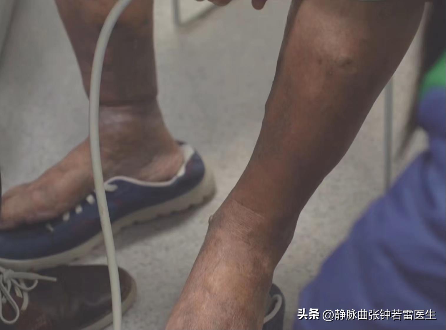 The burden on the shoulders is heavy, but the road under the feet is ...