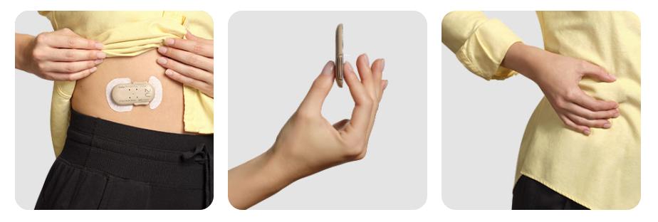 Low-end version of OmniPod?CeQur Simplicity Insulin Patch - iNEWS