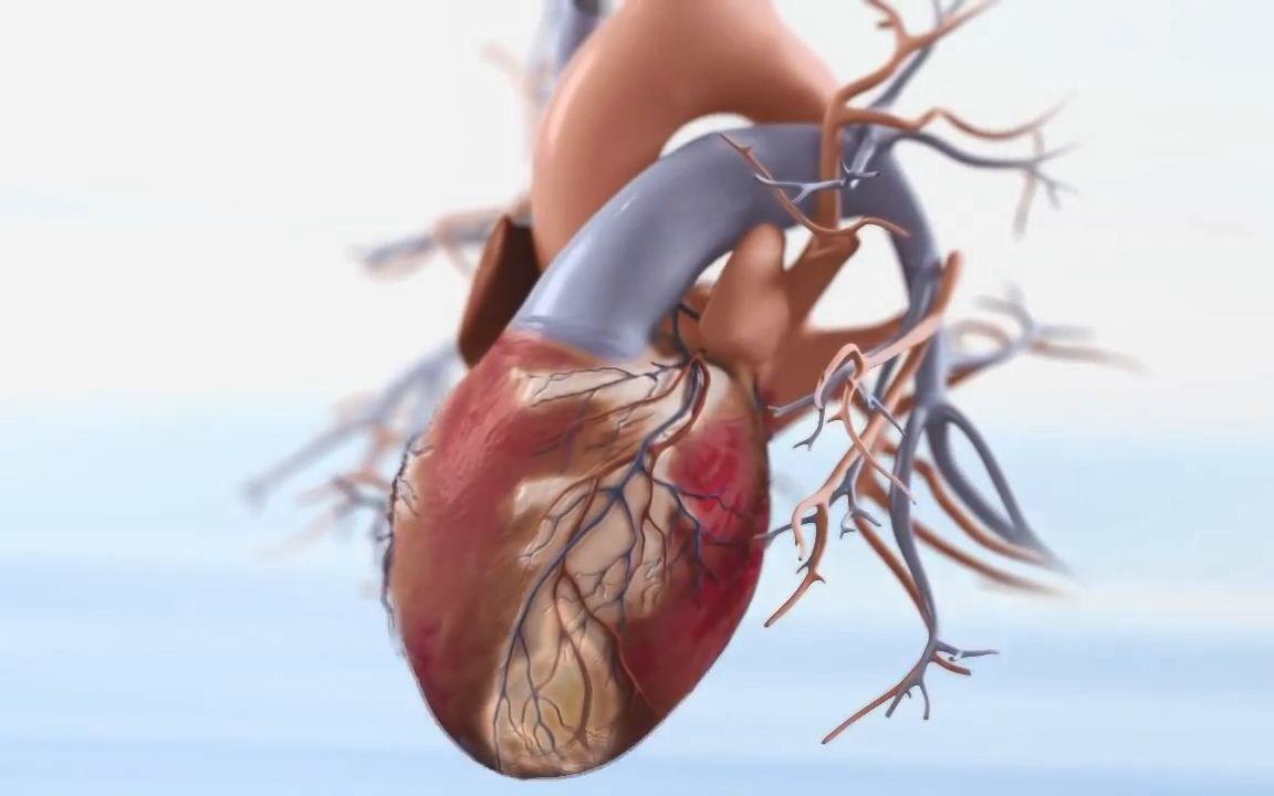 Stroke prevention starts with the heart - iNEWS
