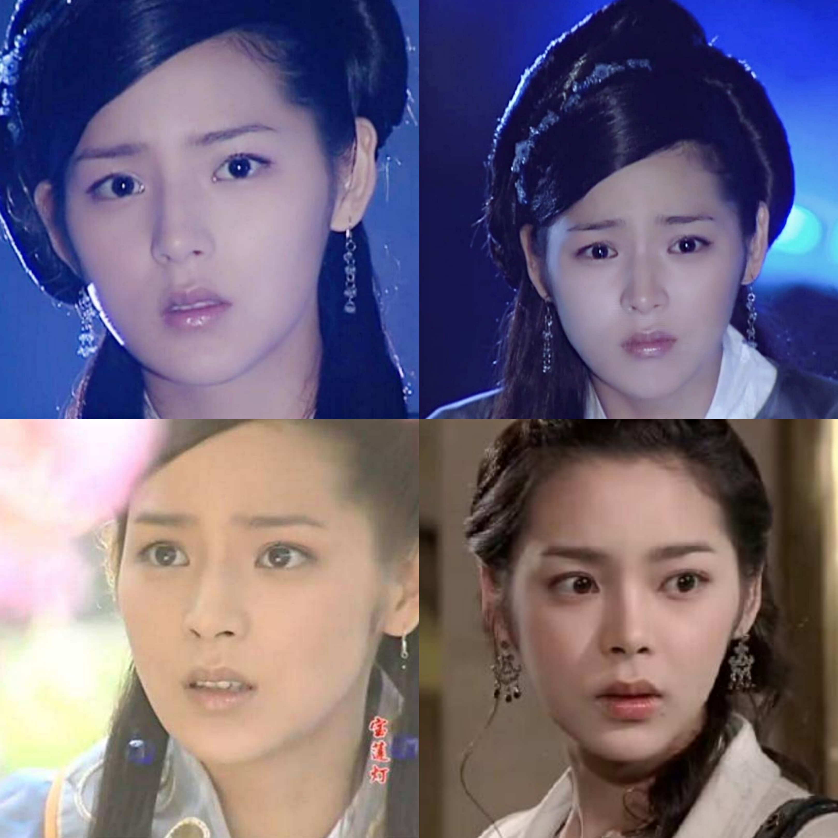 Because plastic surgery ruined their careers, changed their face beyond ...