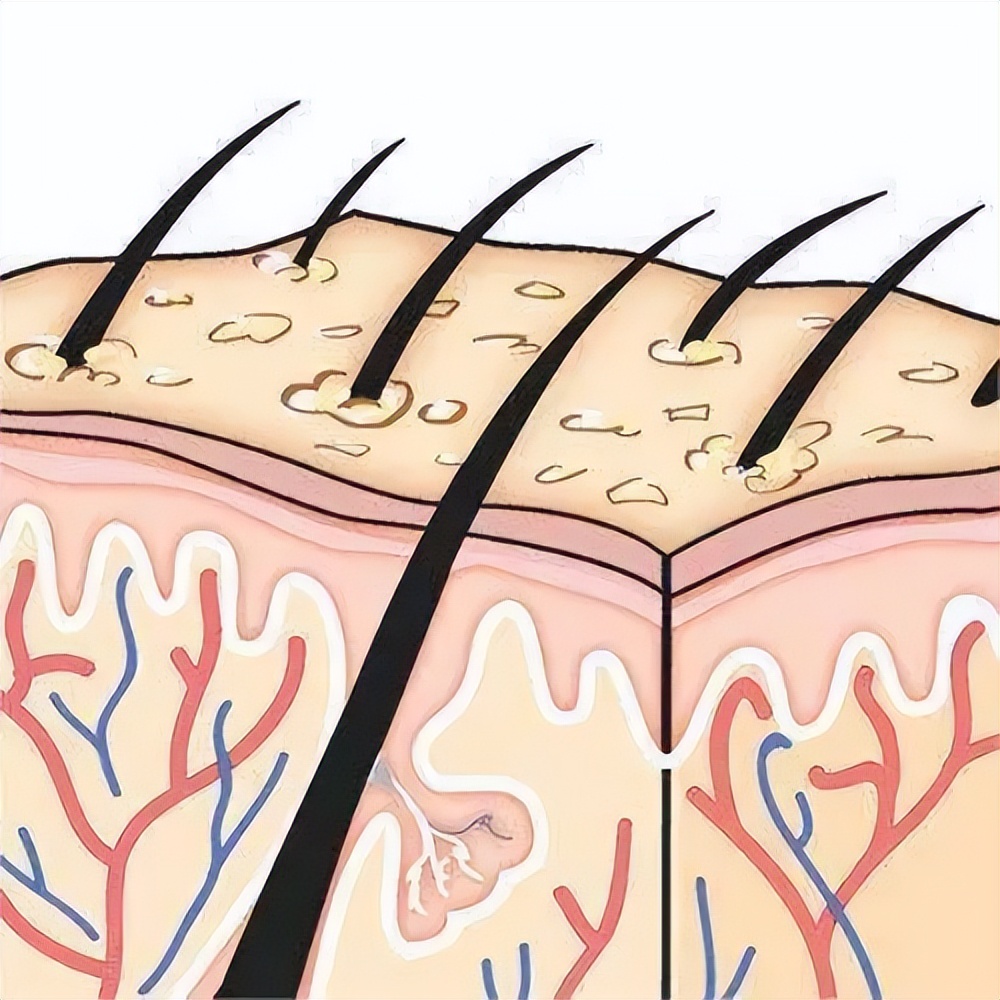 Raising hair first raises the skin, beauty starts from the "head ...