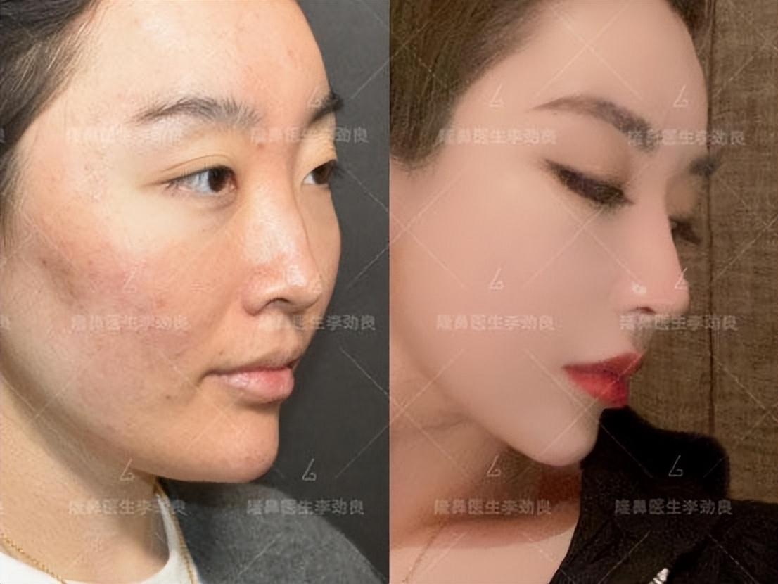 "Till The End Of The Moon" Luo Yunxi plastic surgery or skinny? This is ...