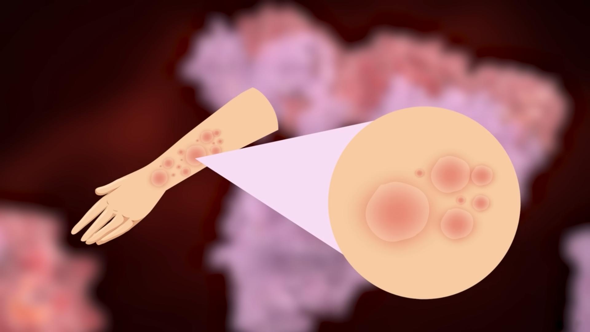 The 5 most dangerous trees in the world, from the fruit to the trunk ...