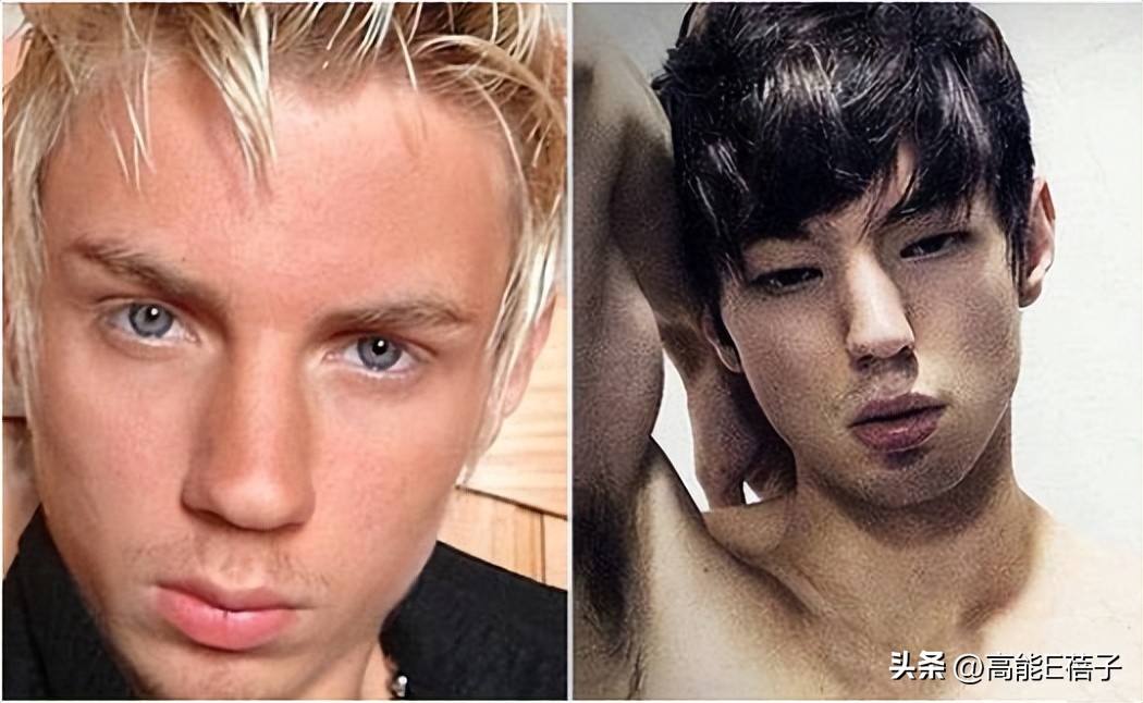 The 22-year-old Canadian actor spent 1.56 million to change his face ...