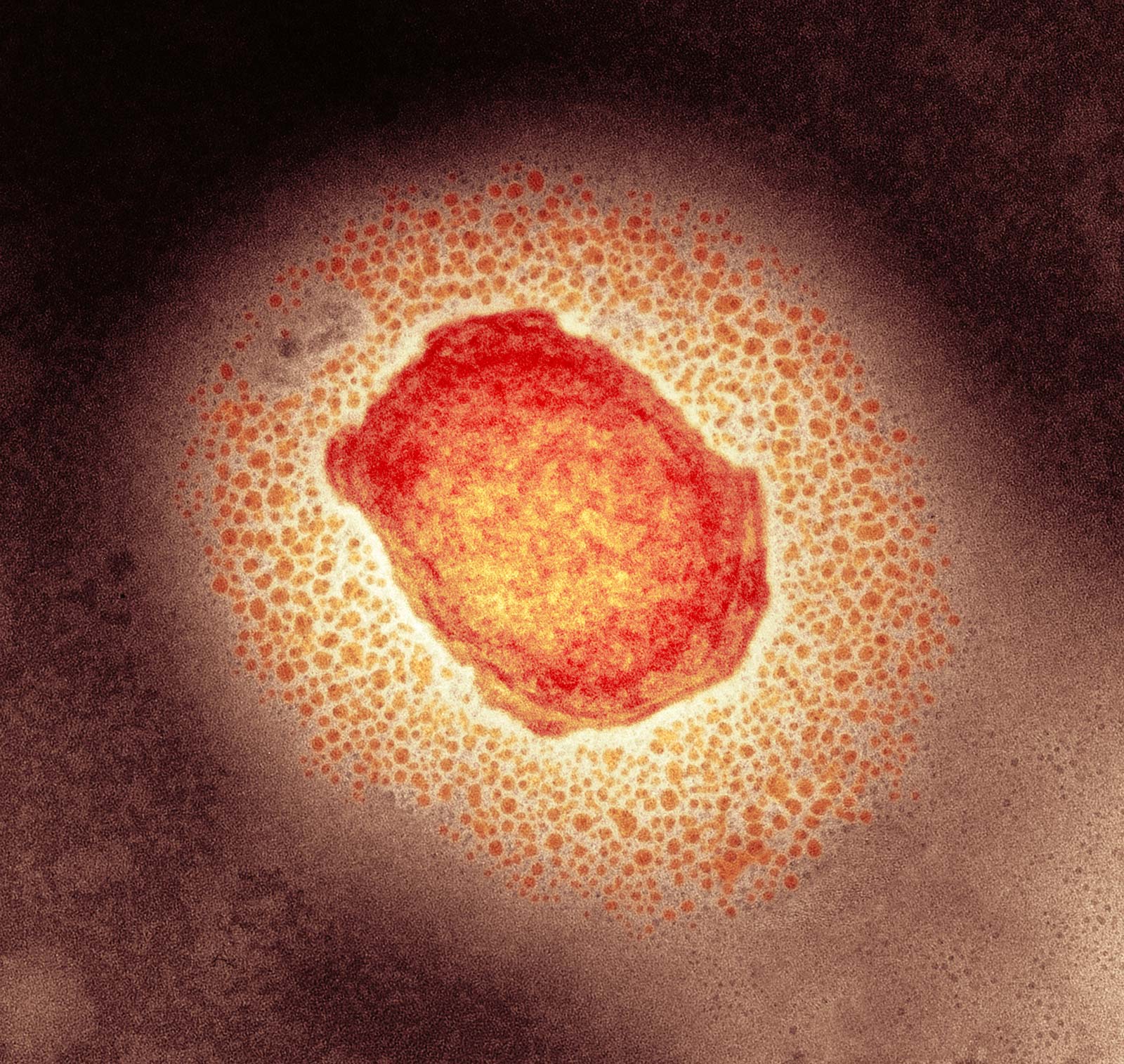 Could monkeypox virus mutate to be more deadly? - iNEWS