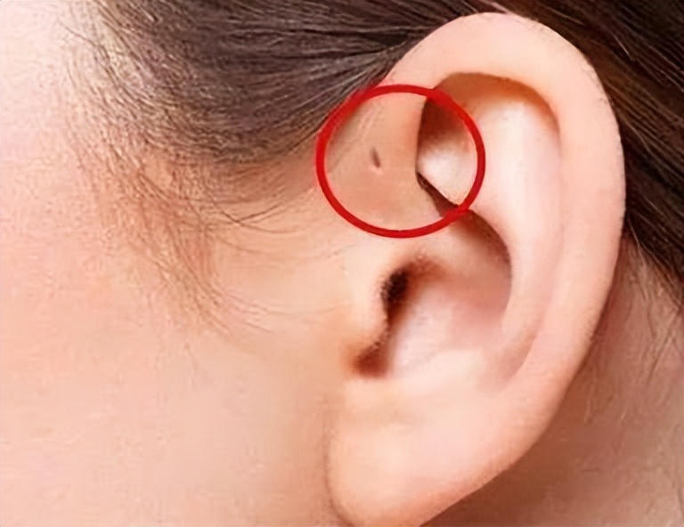 There is a small hole in the ear, called "Darwin's tubercle", what ...