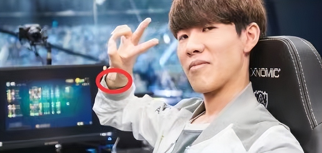 LOL: TheShy underwent eye surgery after a 20cm hand wound, just to get ...