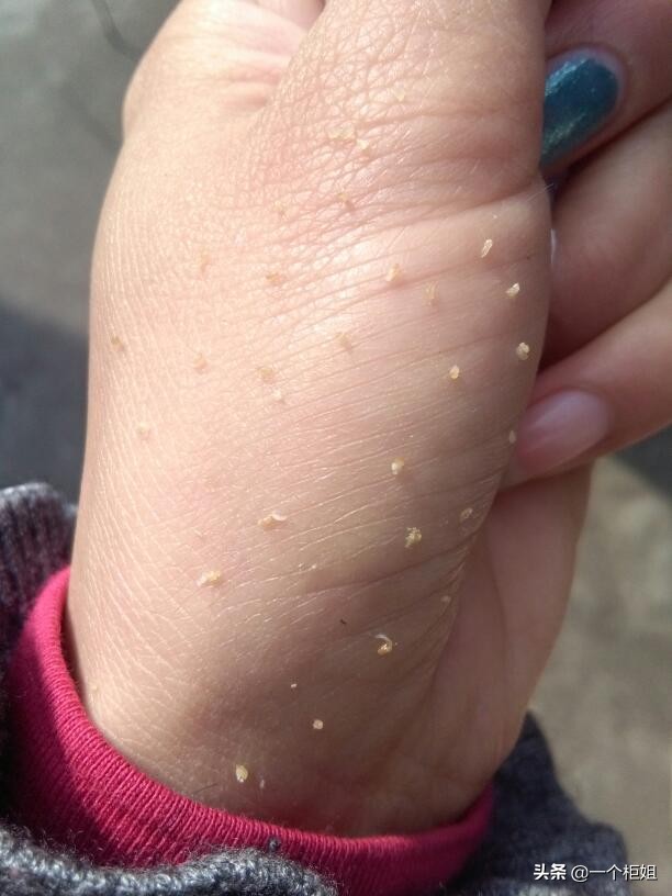 The pores on the nose are large, and yellow millet grains can be ...