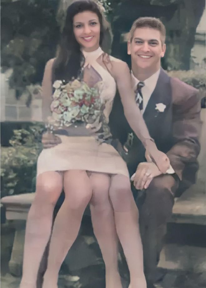 Beautiful Woman Born With Four Legs, Two Reproductive Systems, And ...