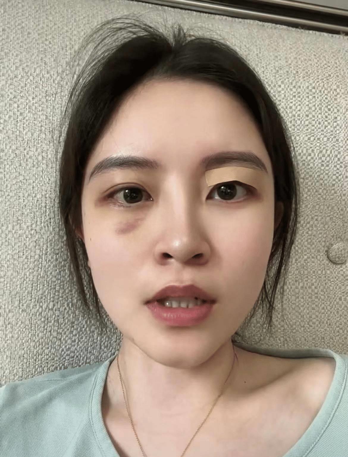 It is revealed that The Voice trainee Su Rui supports Coco Lee! Later ...