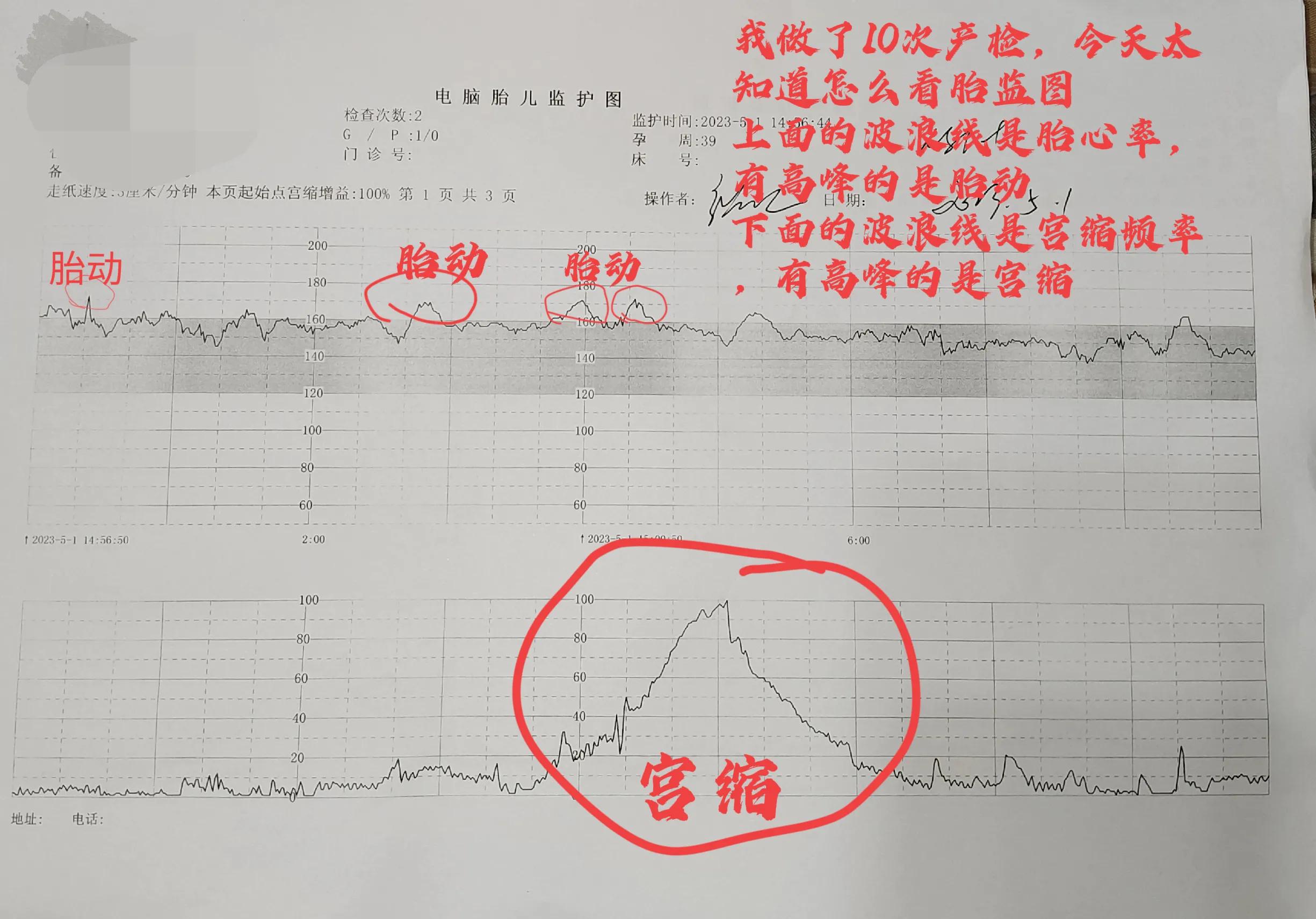 Today is 39 weeks pregnant and I haven't given birth yet, but the ...