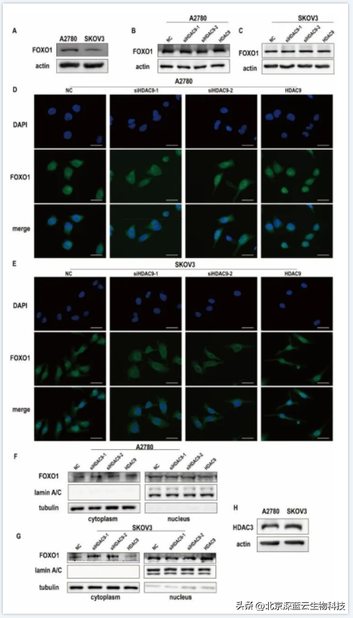 Application of Echo Revolve Microscopy in Epithelial Ovarian Cancer ...