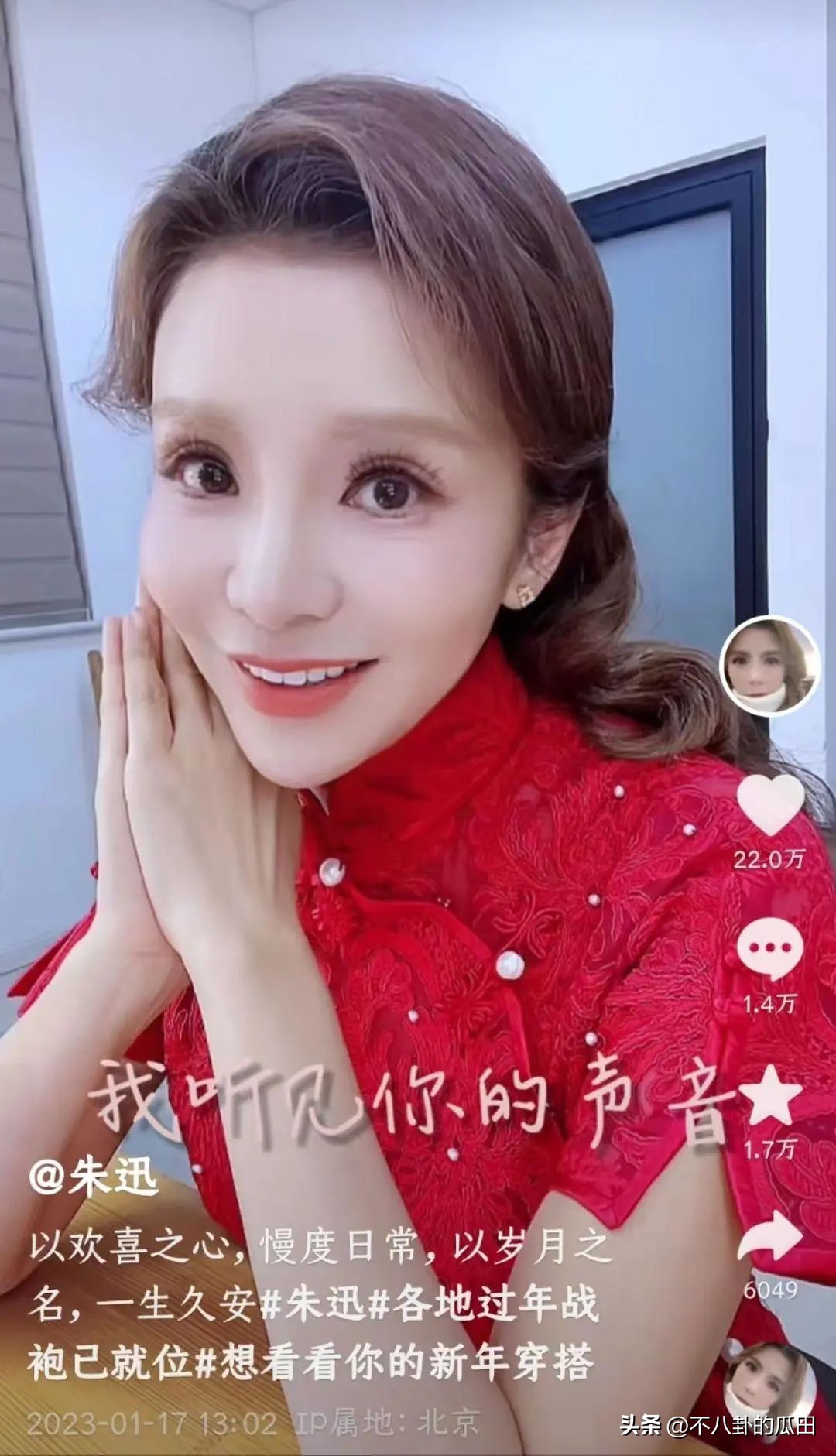 49-year-old Zhu Xun is unrecognizable in recent photos, his eye sockets ...