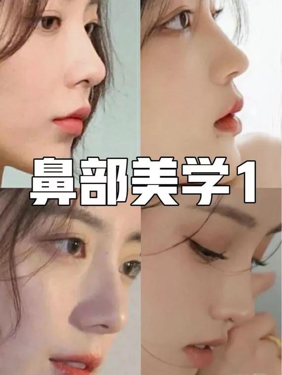 Why do some people have a high nose bridge, but they still don't look ...