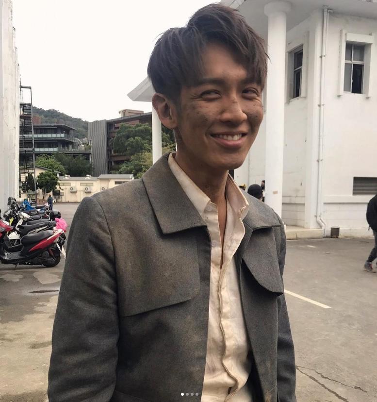 Ke Zhendong had an accident while filming, his face was injured by a ...