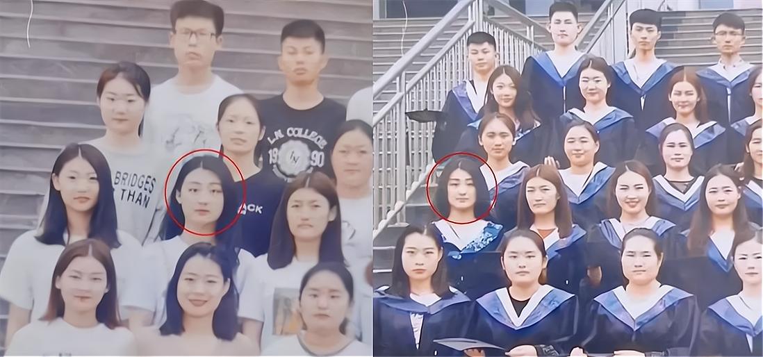 Chen Yanan responded to the plastic surgery crisis for the first time ...