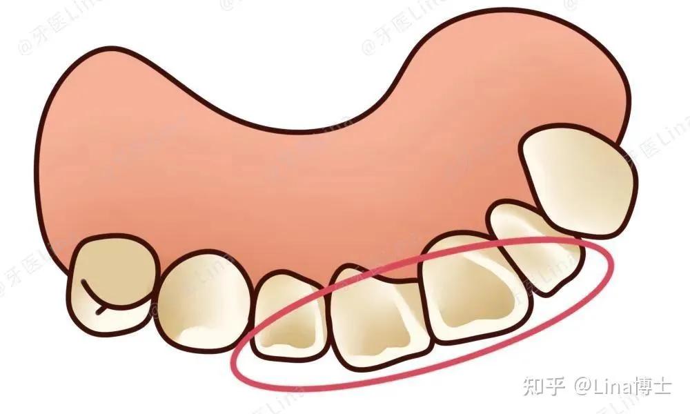 Chinese shovel-shaped incisor gene reveals origin mystery - iNEWS