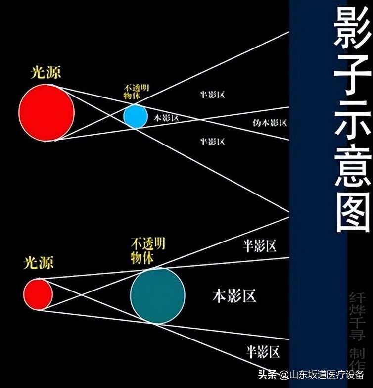 What exactly is a surgical shadowless light? - iNEWS