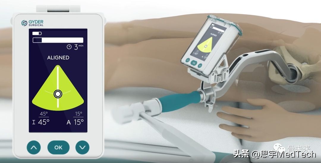 first! Aviation Technology for Hip Navigation Systems - iMedia