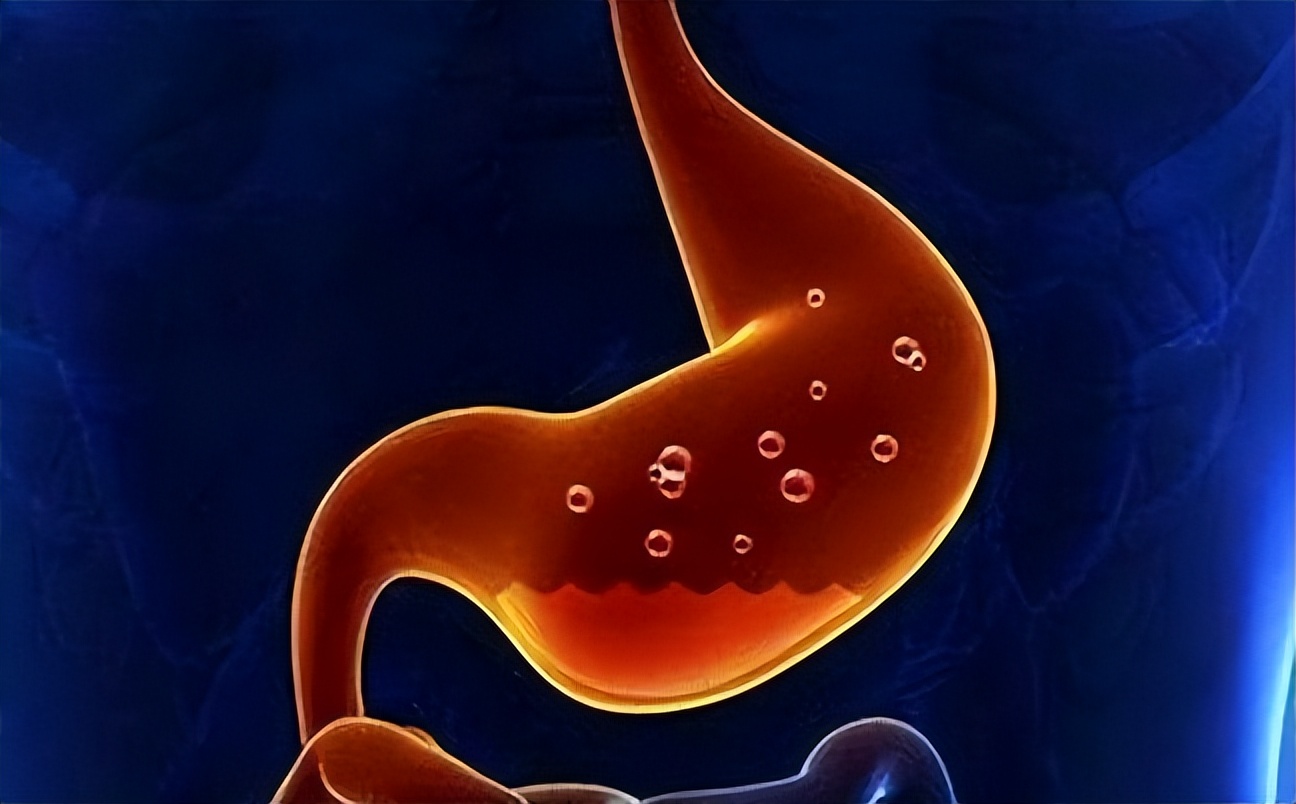 Bezoar detoxification tablets, which are always available at home, can ...