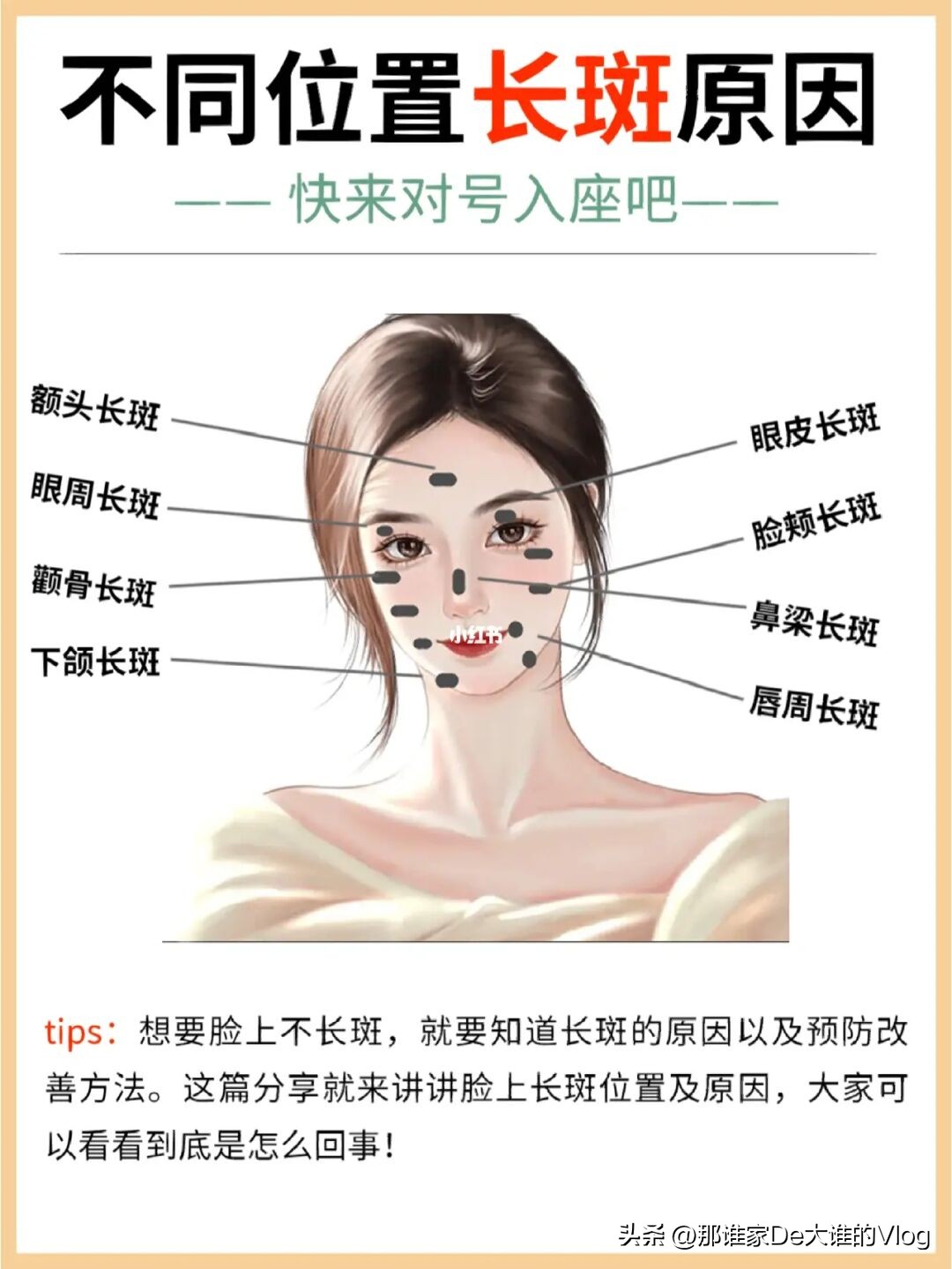 Reasons and suggestions for freckles in 8 locations‼ ️Super detailed ...