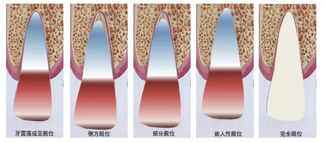 Dental Adventures (Episode 7) The permanent tooth was bruised - iNEWS