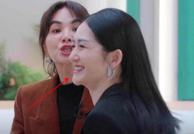 What is the difference between an injection face and a natural face ...